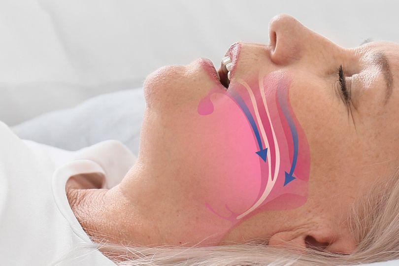 ORL | Klinika komplexní péče